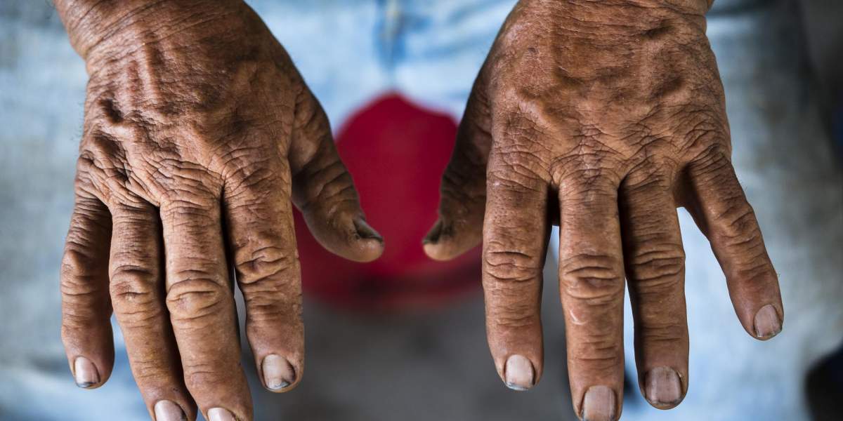 The Hands That Feed Us • Mad Agriculture • Regenerative Farming